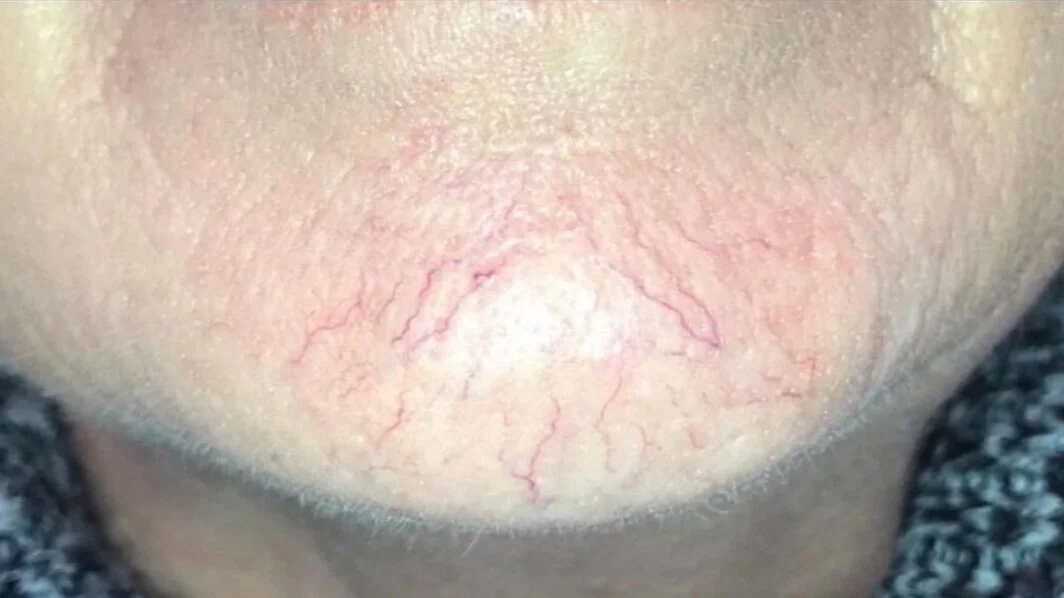 ThermoClear Services — HEY BUTTERFLY