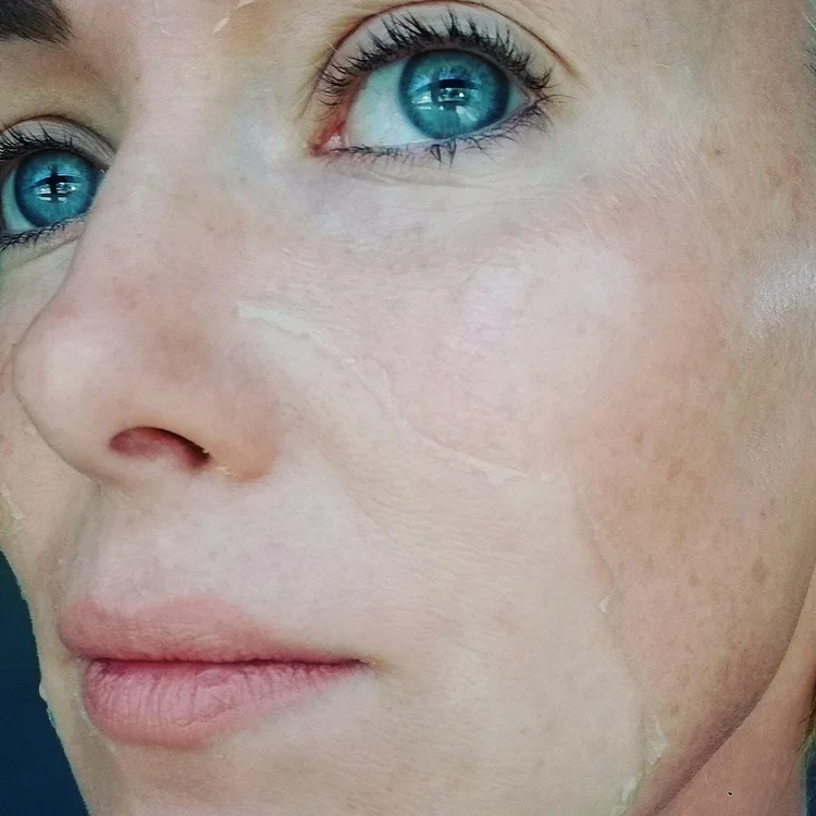 The Perfect Derma Peel — HEY BUTTERFLY