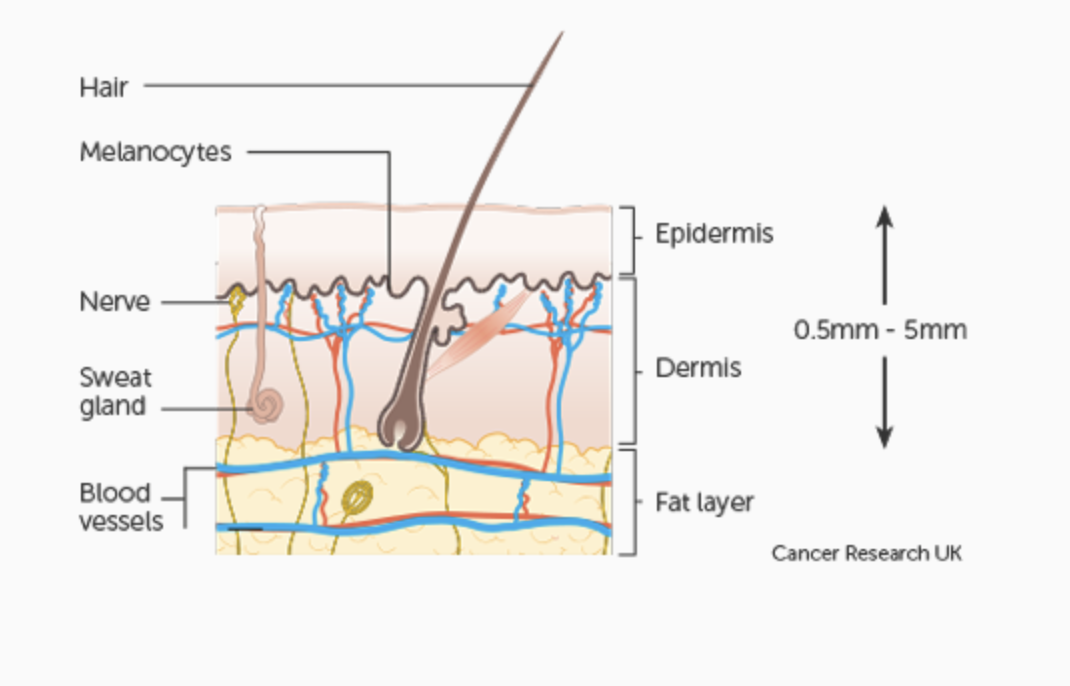 What is skin cancer — The MOLE Clinic