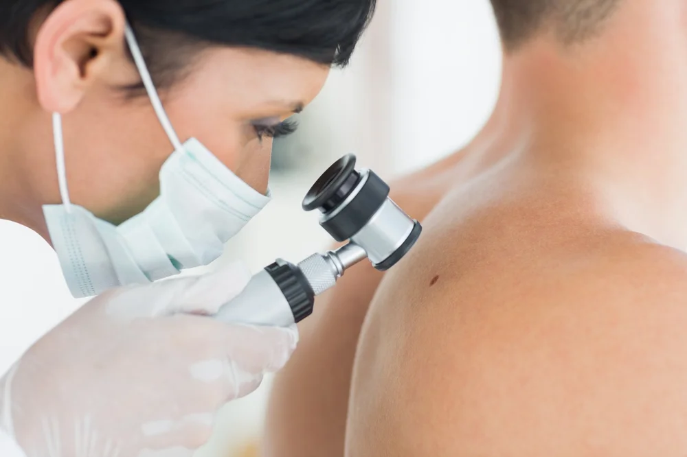 The MOLE Clinic - Skin Cancer Check & Mole Removal Specialists
