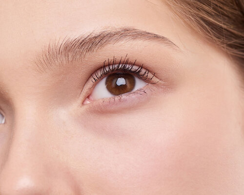 Crow's Feet and Under-Eye Lines: What Are They and What Should You Do ...