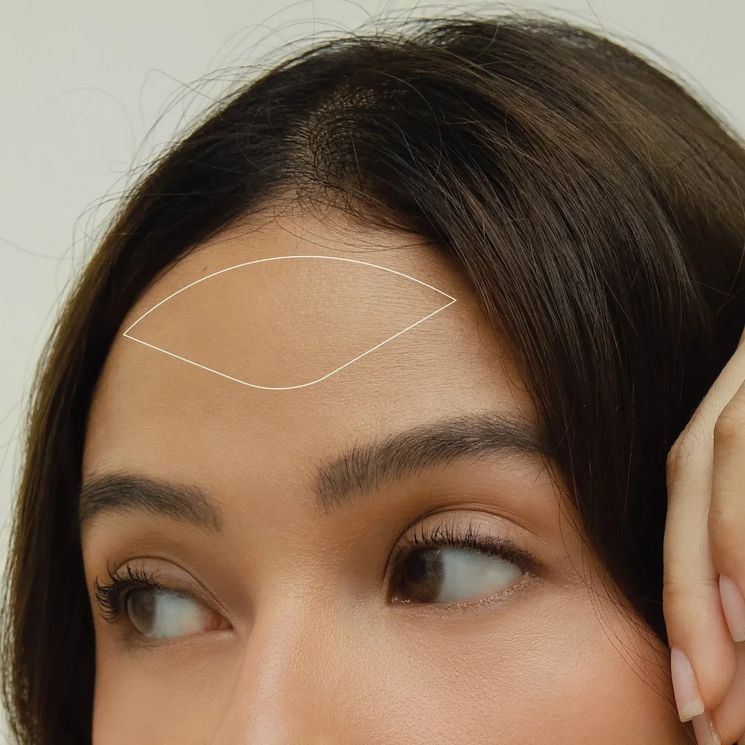 Botox® Price & Areas — Simply Skin