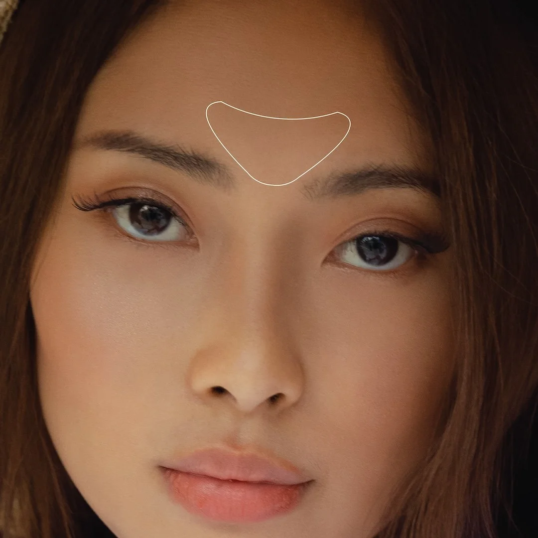 Botox® Price & Areas — Simply Skin