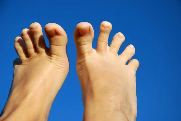 What is a Claw Toe - Top 5 Causes, Best Treatment, and Prevention ...