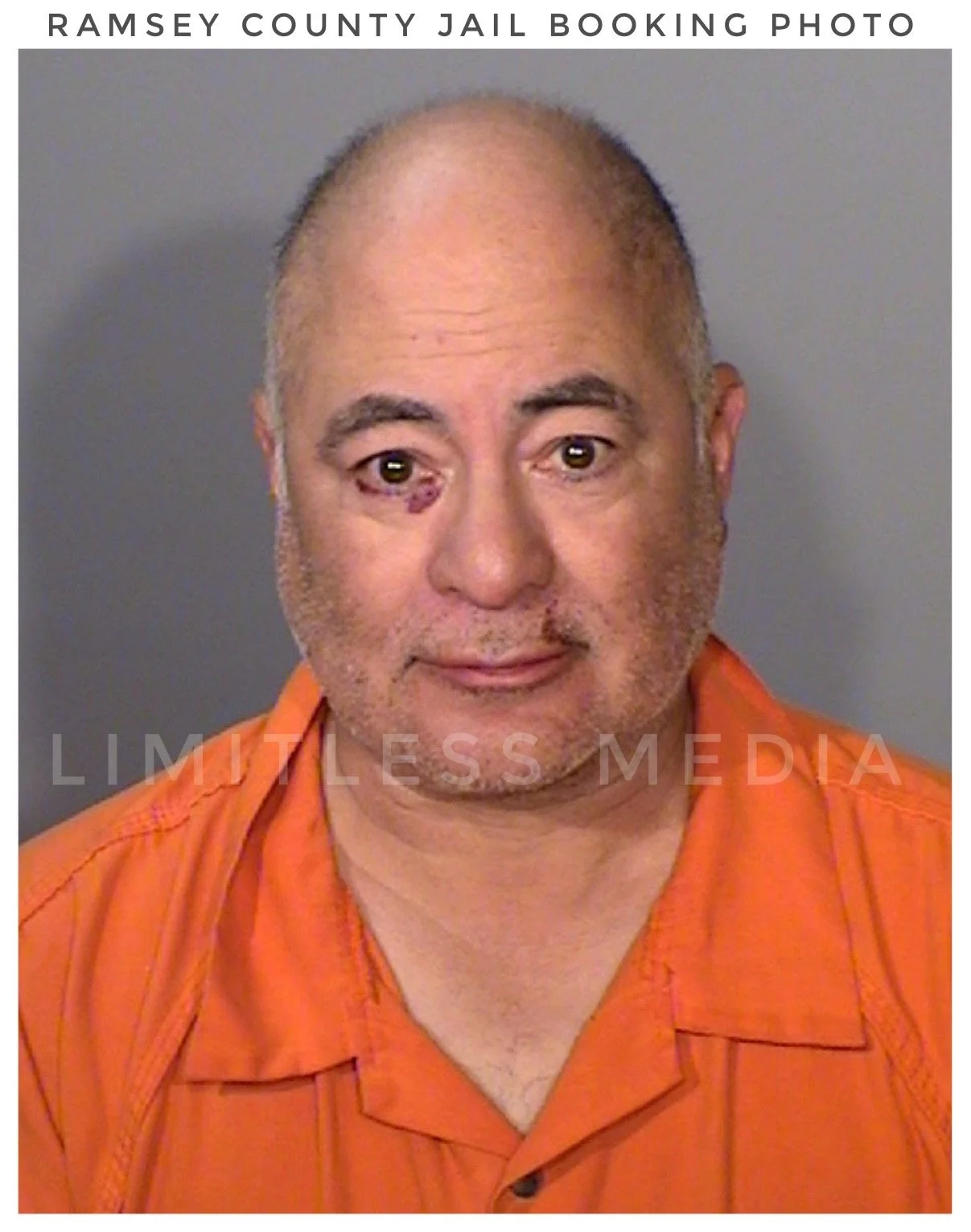 White Bear Lake Man Charged in Fatal DWI Crash That Killed Motorcyclist ...