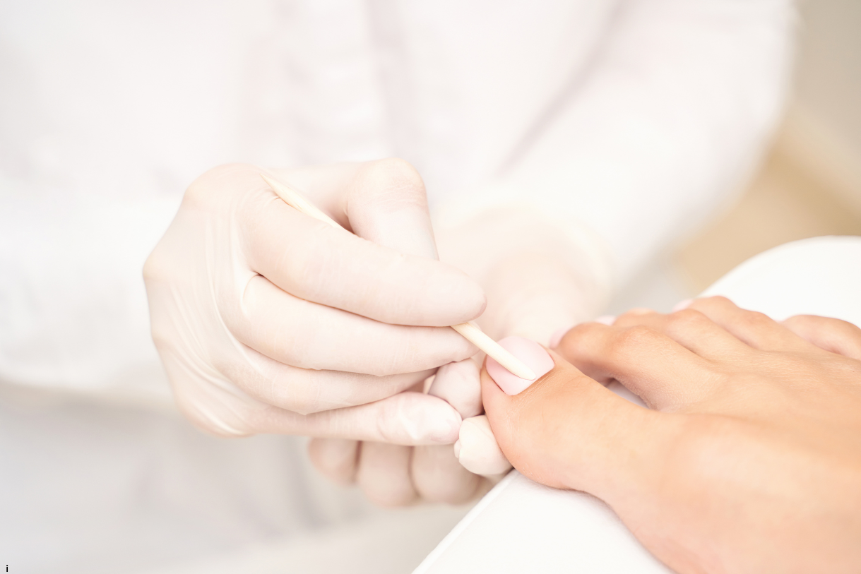 Nail Reconstruction — The Foot Company
