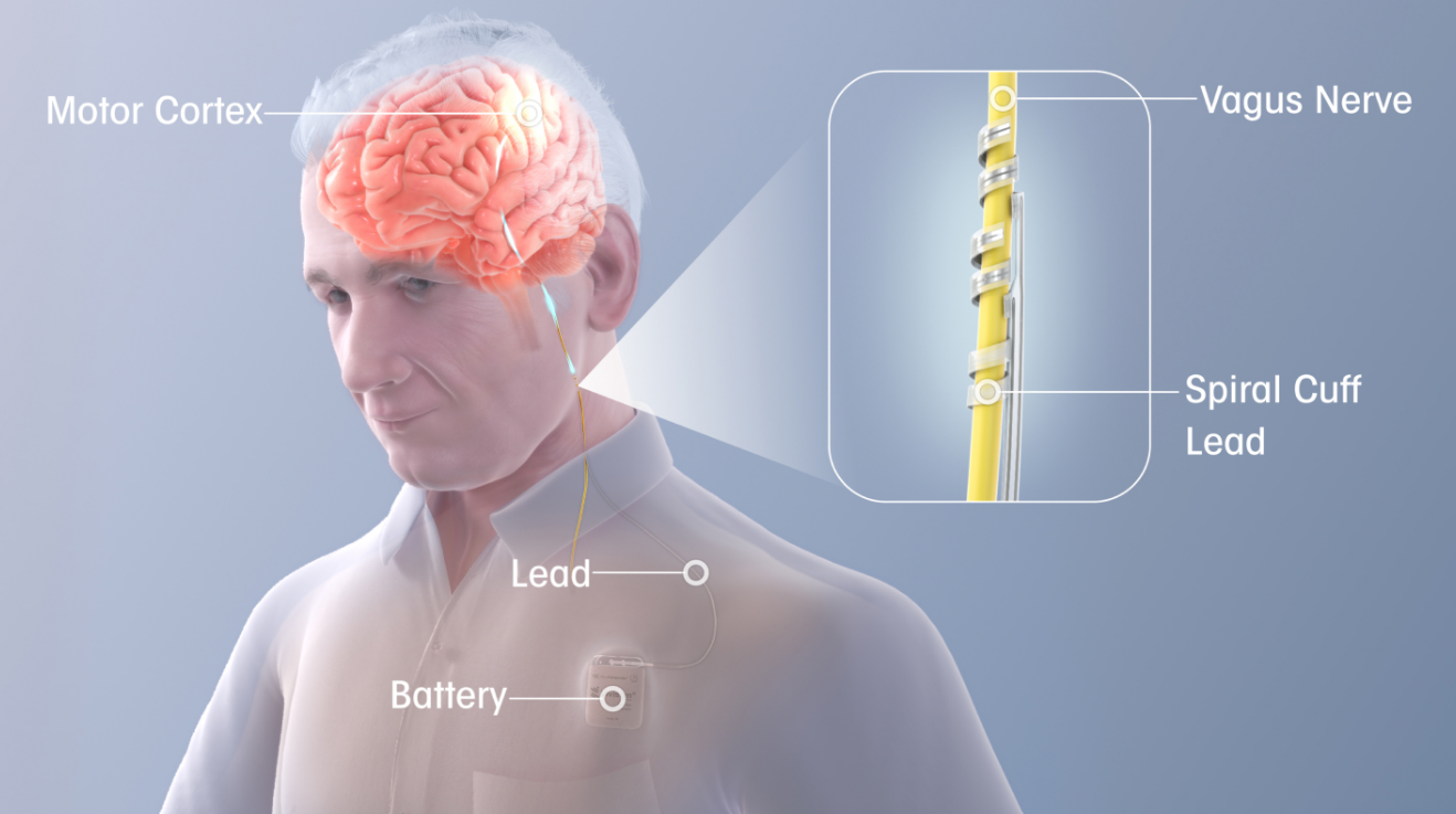 Vivistim — NeuroLab 360
