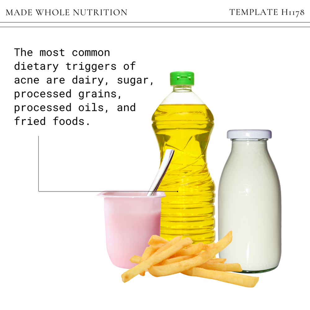 Acne Nutrition: foods that trigger & tame — Functional Health Research ...