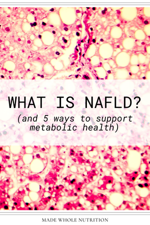 What is NAFLD? (and 5 ways to support metabolic health) — Functional ...