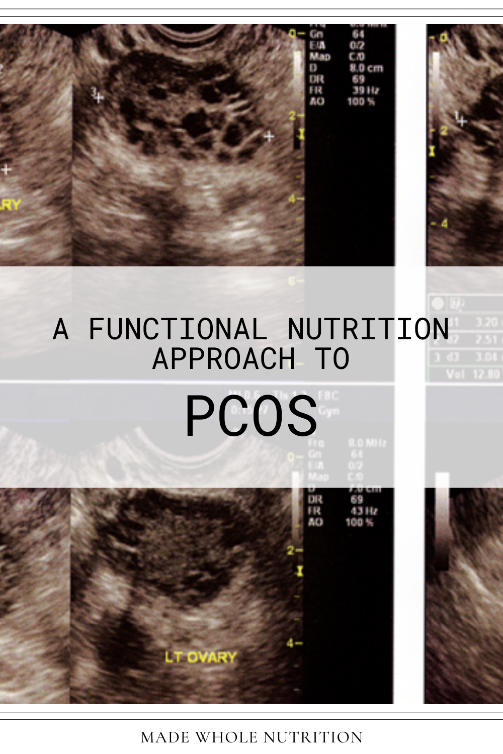 A Functional Nutrition Approach to PCOS — Functional Health Research ...