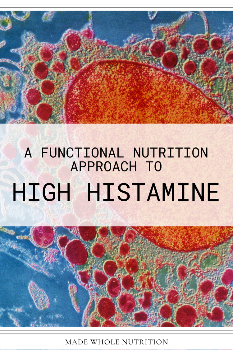 A Functional Nutrition Approach to High Histamine — Functional Health ...
