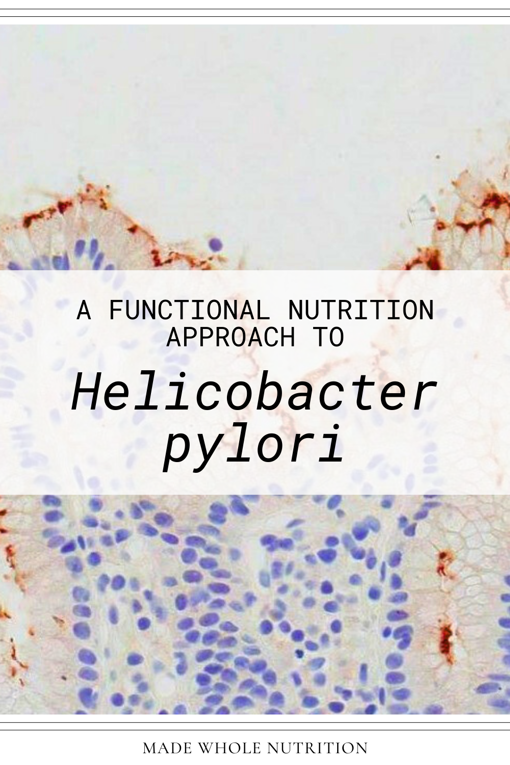 A Functional Nutrition Approach to Helicobacter pylori — Functional ...