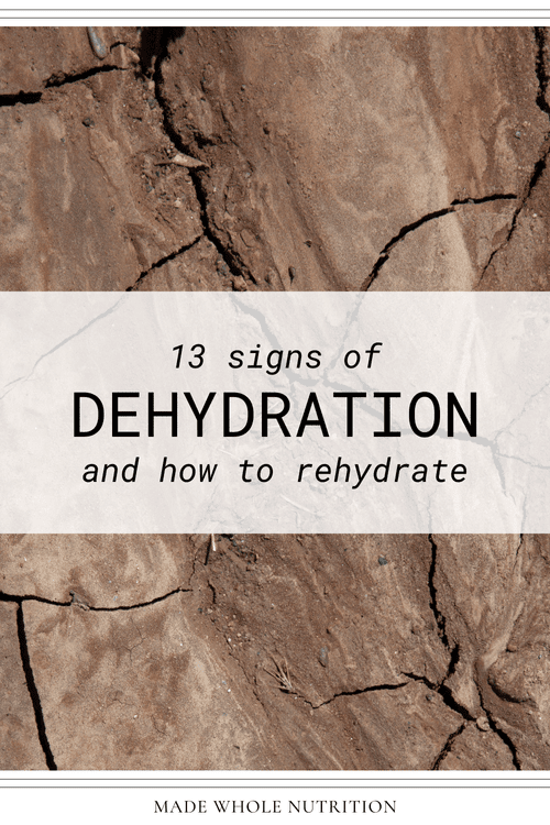 13 Signs of DEHYDRATION (and how to rehydrate) — Functional Health ...