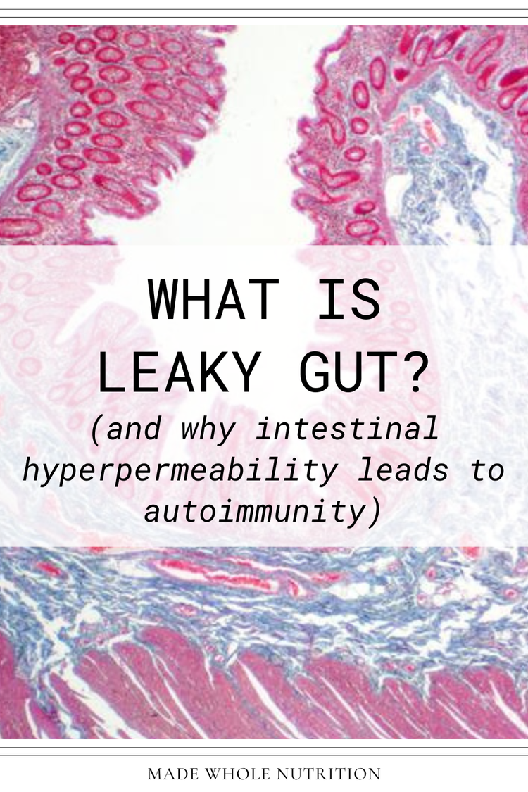 What is LEAKY GUT? (and why intestinal hyperpermeability leads to ...