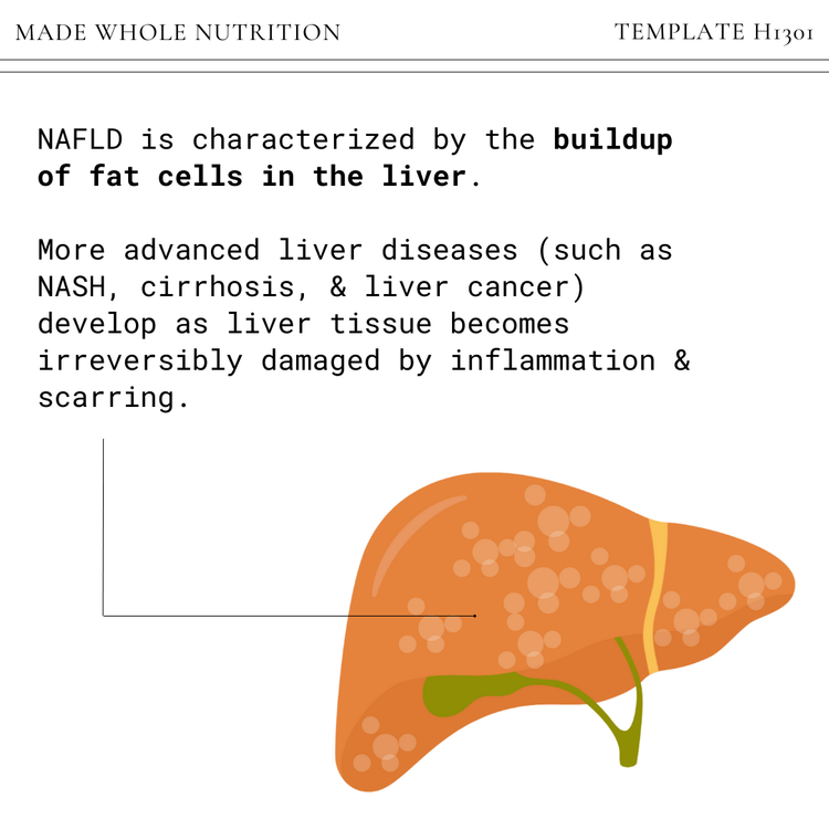 What is NAFLD? (and 5 ways to support metabolic health) — Functional ...