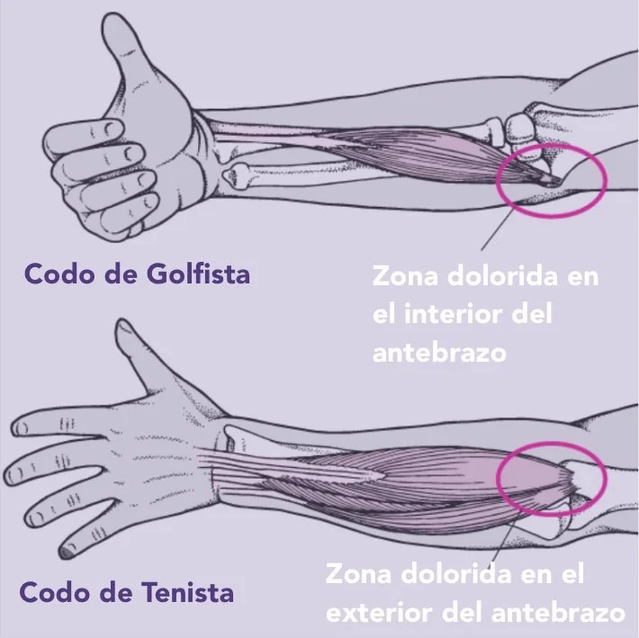 Dolor de codo y cómo recuperar la movilidad. — Clínica Company