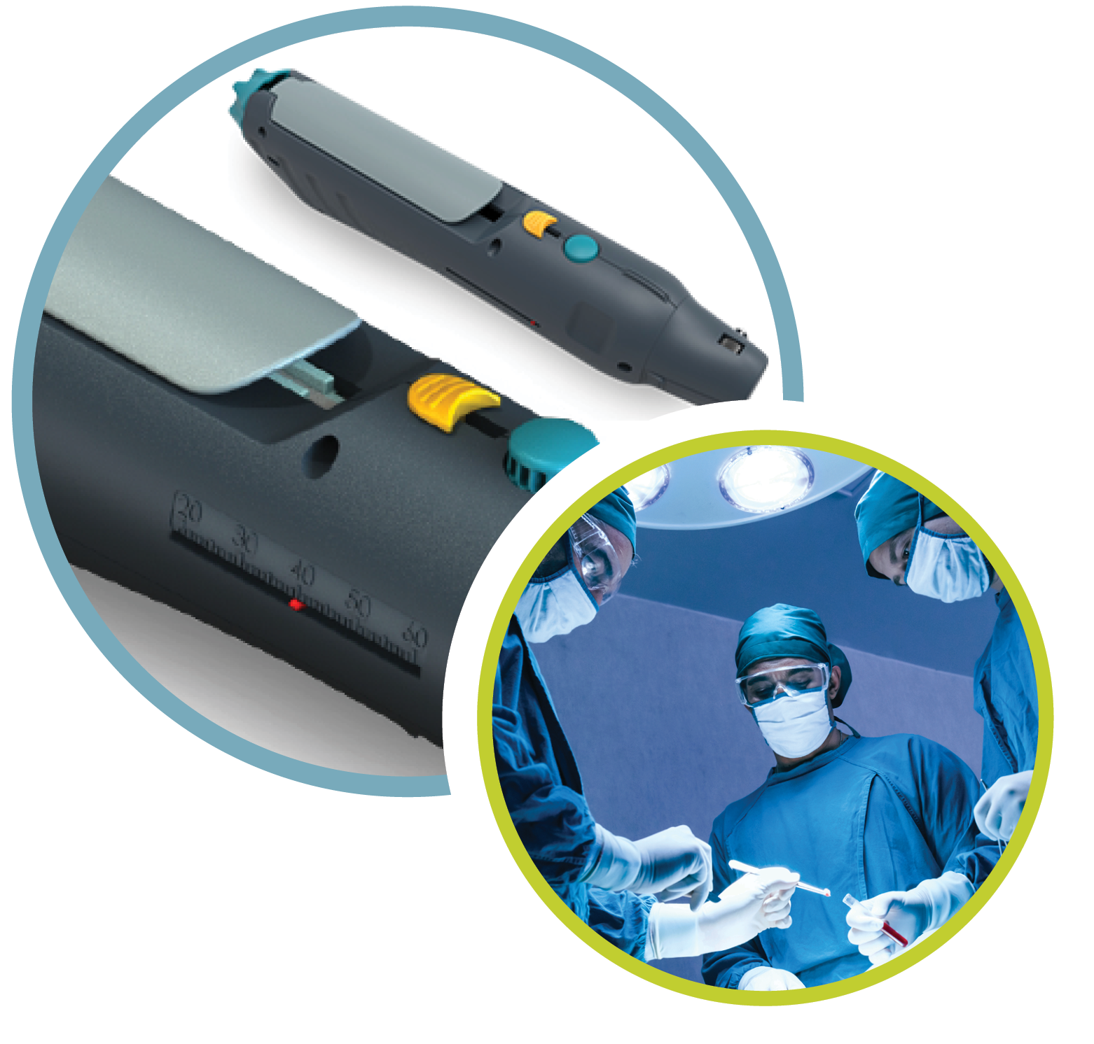 Triopsy | Improving Cancer Diagnosis