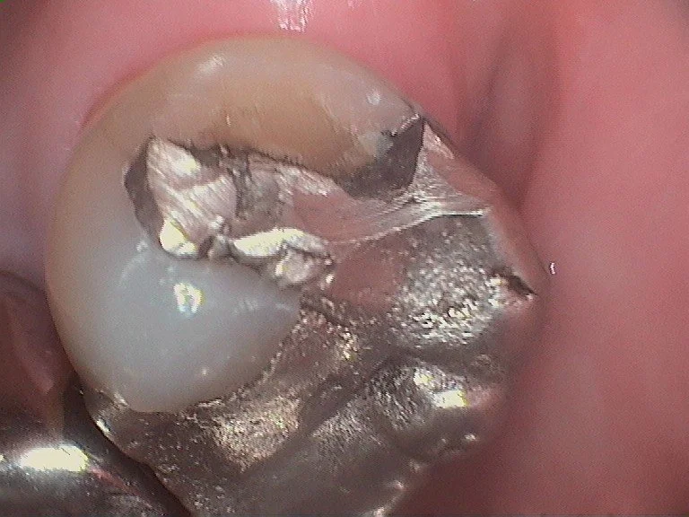 THE BIOCLEAR MATRIX SYSTEM — Maribel M. Vann DDS