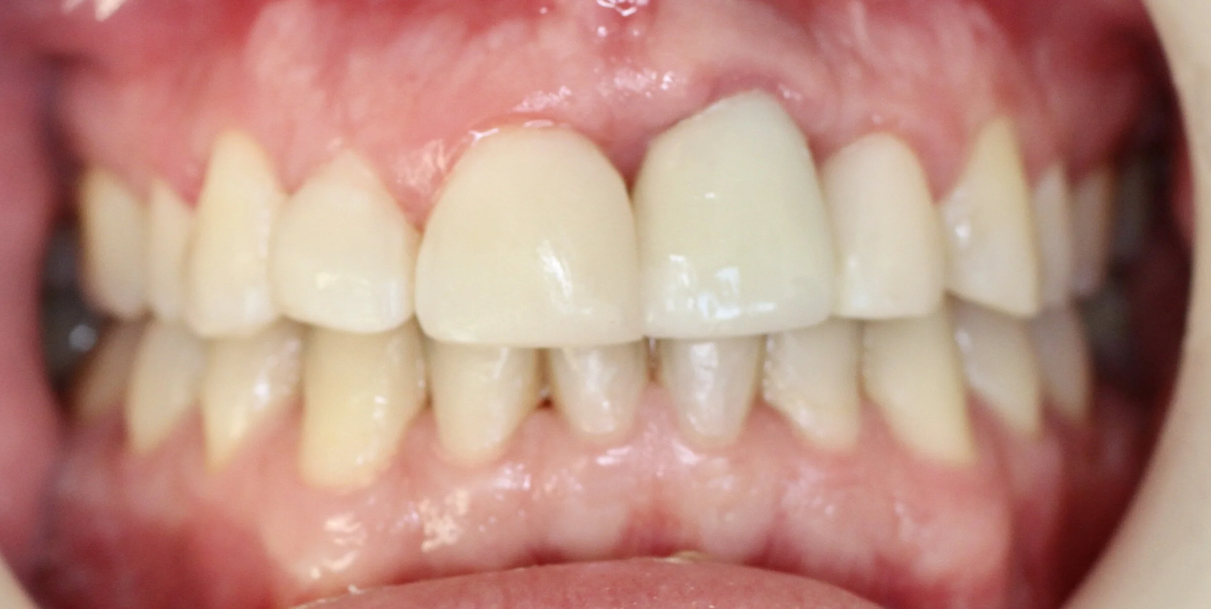 THE BIOCLEAR MATRIX SYSTEM — Maribel M. Vann DDS