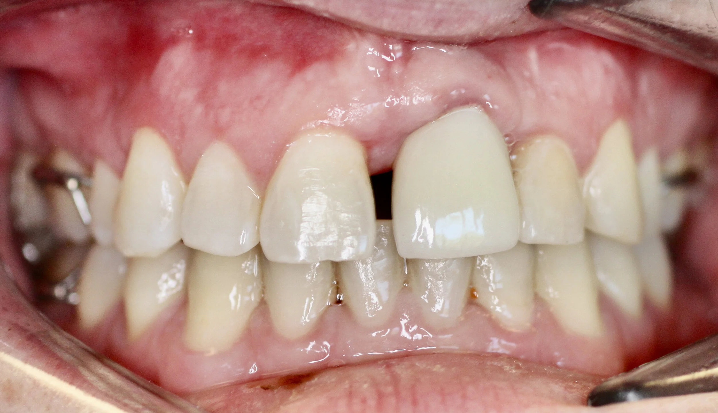 THE BIOCLEAR MATRIX SYSTEM — Maribel M. Vann DDS
