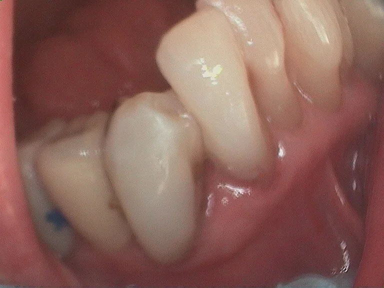 THE BIOCLEAR MATRIX SYSTEM — Maribel M. Vann DDS