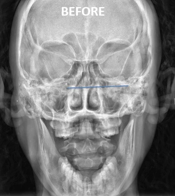 TMJ & ALF TREATMENT — Maribel M. Vann DDS