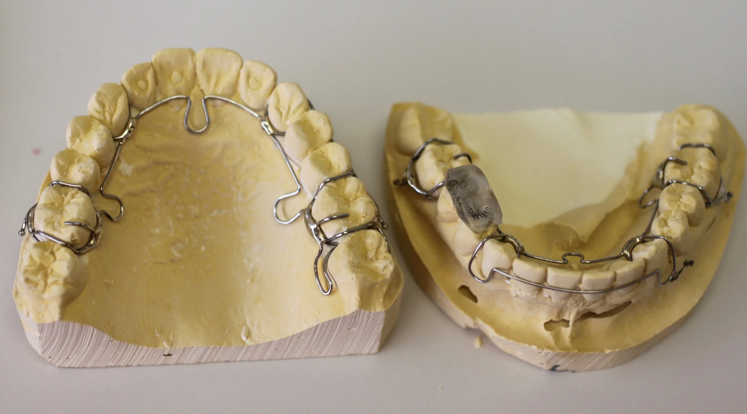 TREATMENT OF TMJ/ALF DISORDER — Maribel M. Vann DDS