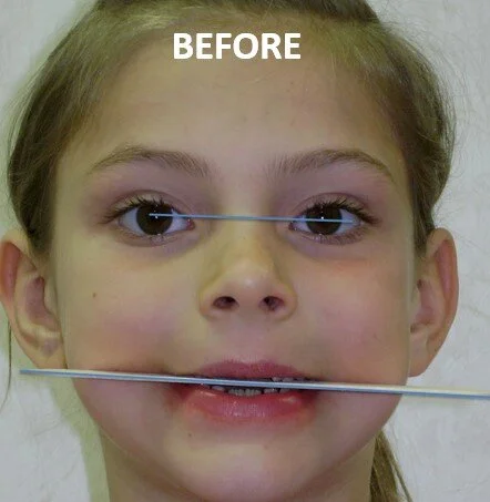 TMJ & ALF TREATMENT — Maribel M. Vann DDS