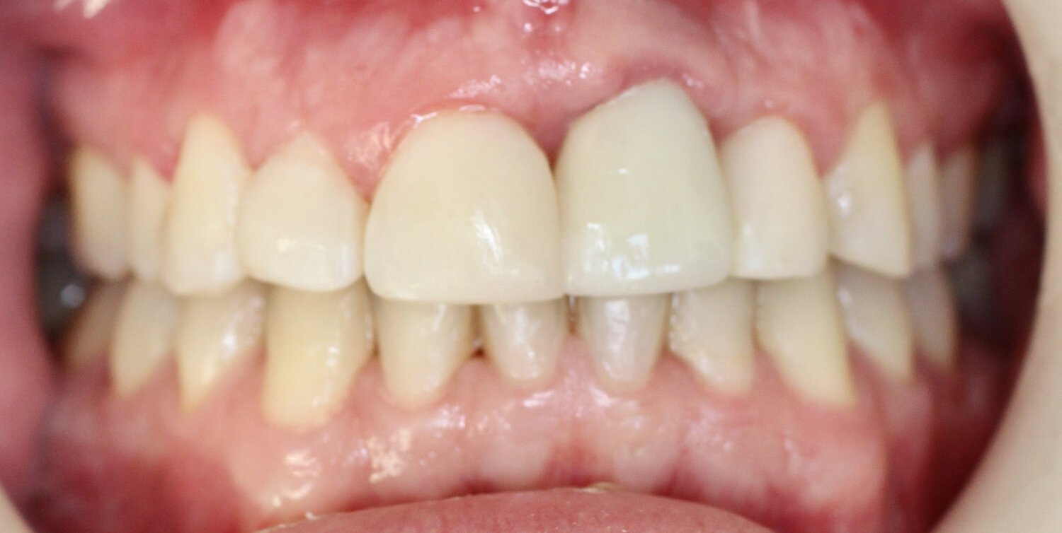 THE BIOCLEAR MATRIX SYSTEM — Maribel M. Vann DDS