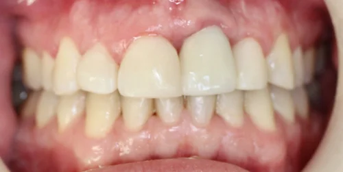 THE BIOCLEAR MATRIX SYSTEM — Maribel M. Vann DDS