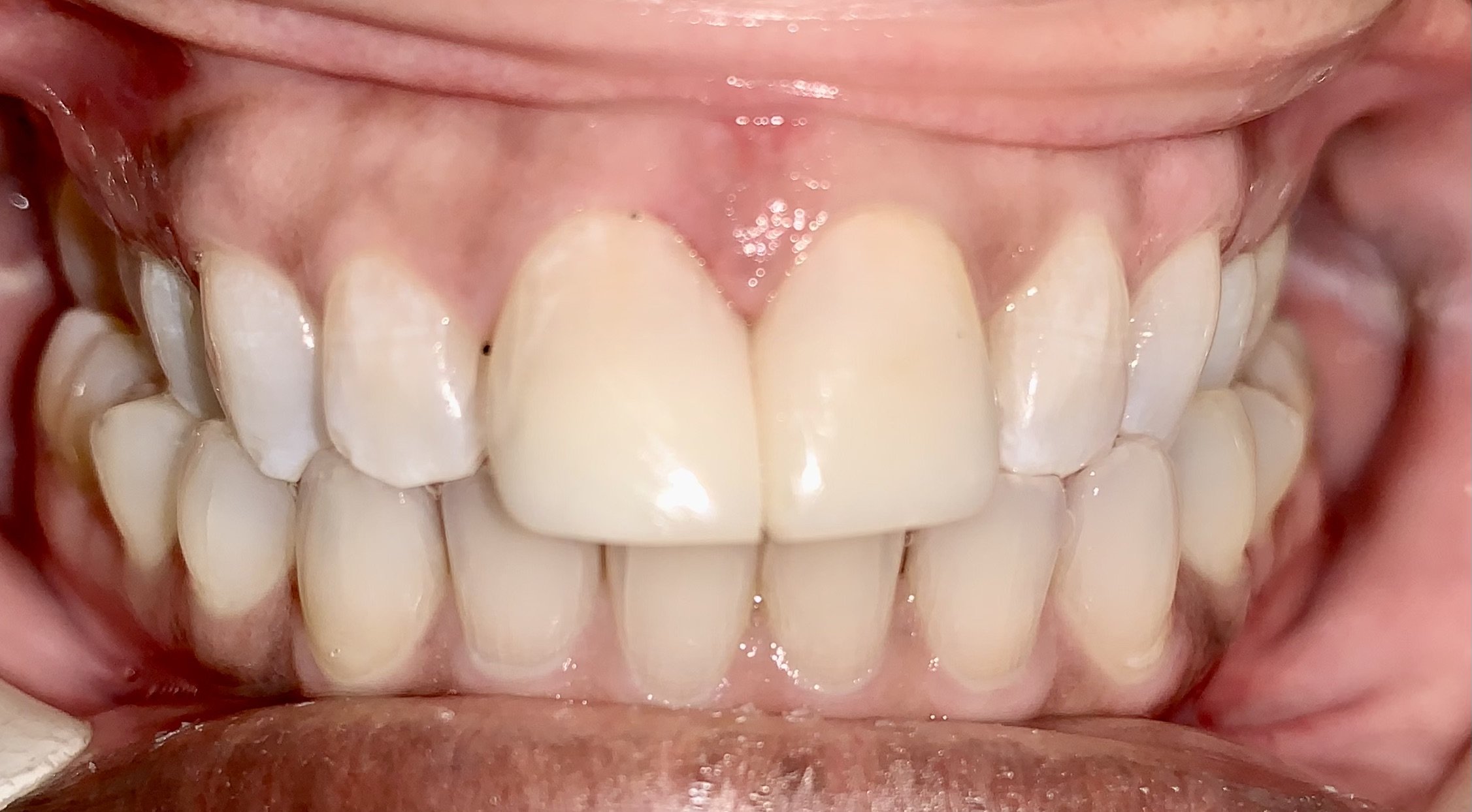 THE BIOCLEAR MATRIX SYSTEM — Maribel M. Vann DDS