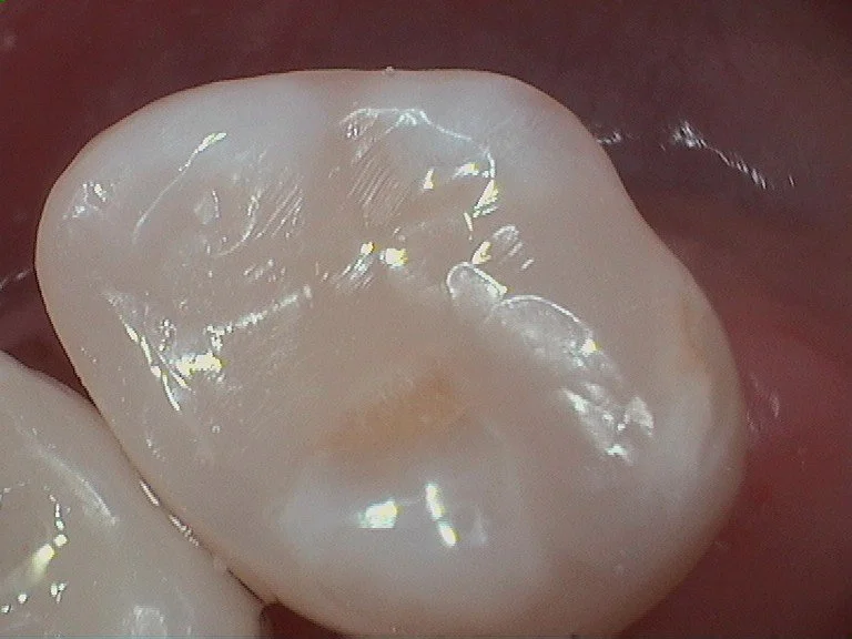 THE BIOCLEAR MATRIX SYSTEM — Maribel M. Vann DDS