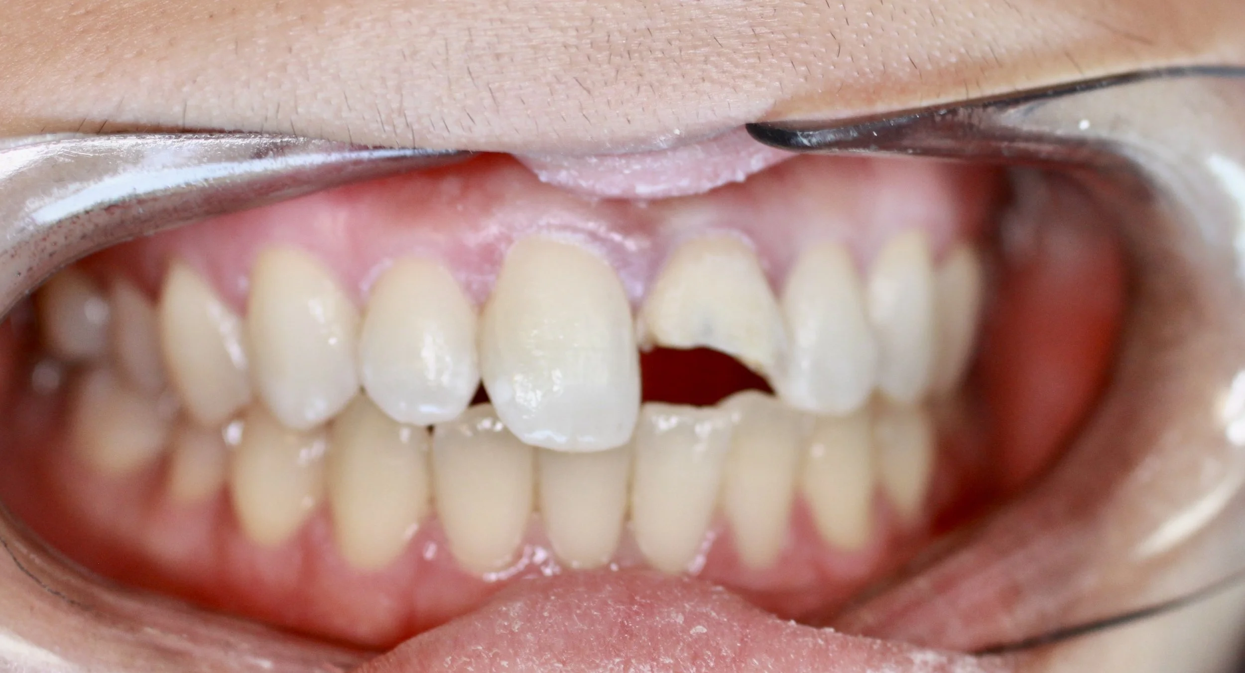 THE BIOCLEAR MATRIX SYSTEM — Maribel M. Vann DDS