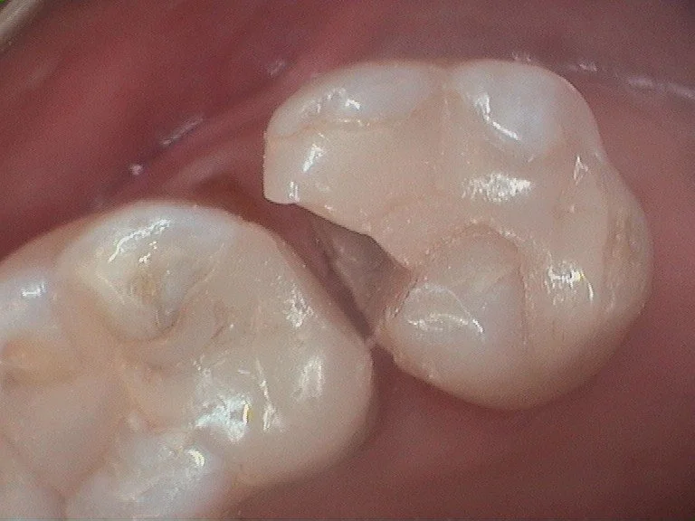 THE BIOCLEAR MATRIX SYSTEM — Maribel M. Vann DDS