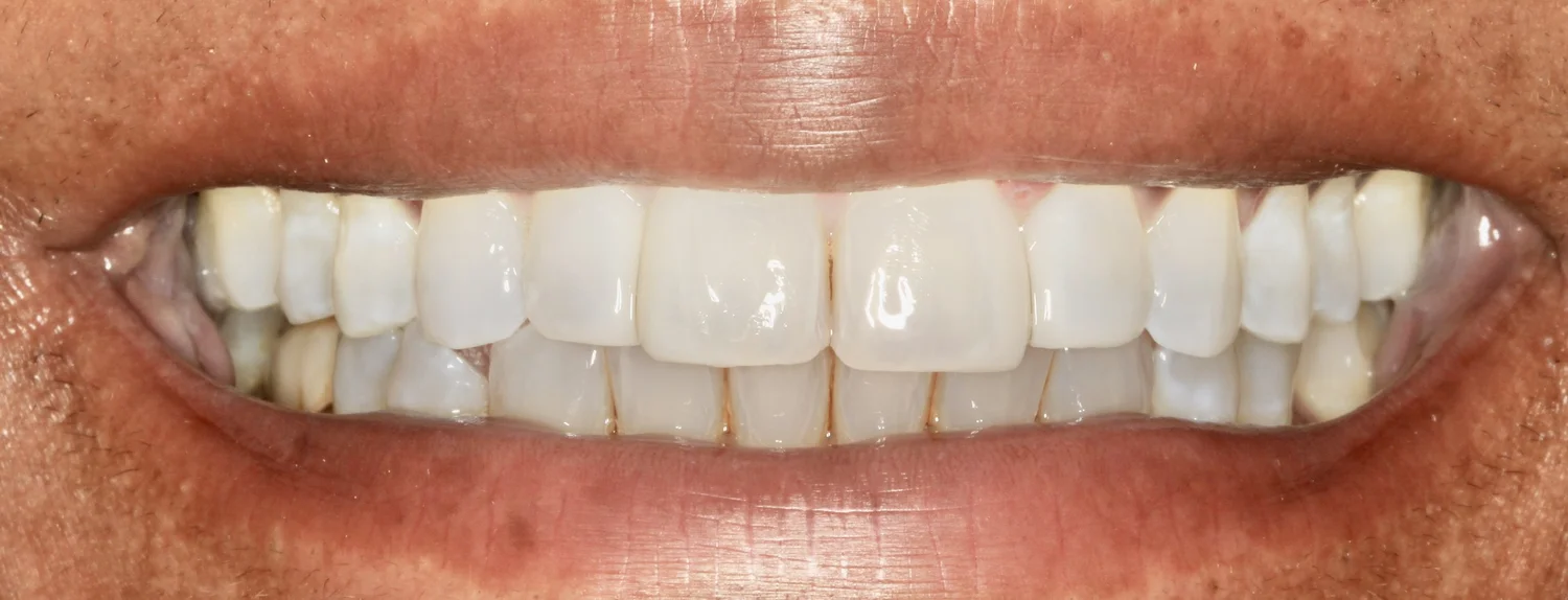 THE BIOCLEAR MATRIX SYSTEM — Maribel M. Vann DDS