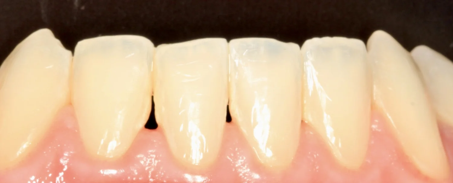 THE BIOCLEAR MATRIX SYSTEM — Maribel M. Vann DDS