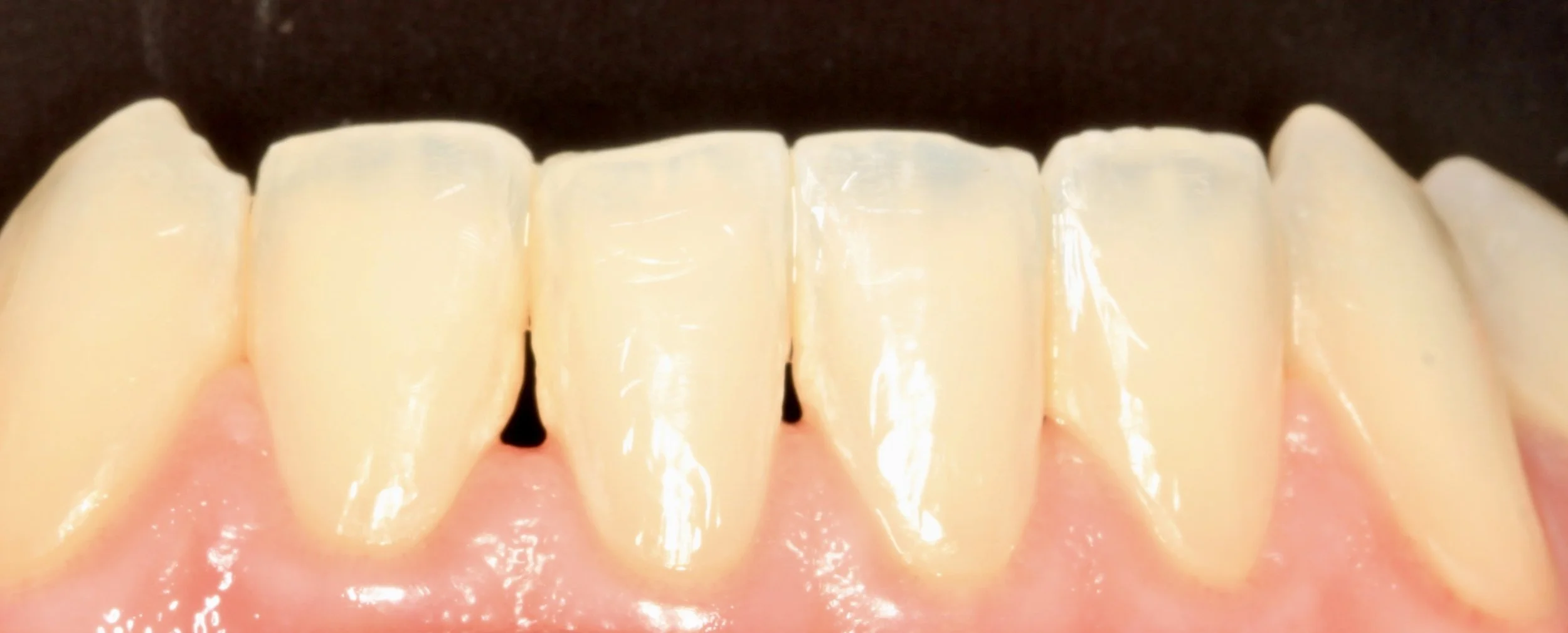 THE BIOCLEAR MATRIX SYSTEM — Maribel M. Vann DDS