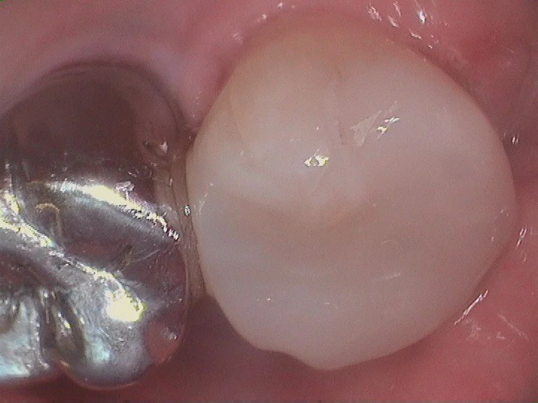 THE BIOCLEAR MATRIX SYSTEM — Maribel M. Vann DDS