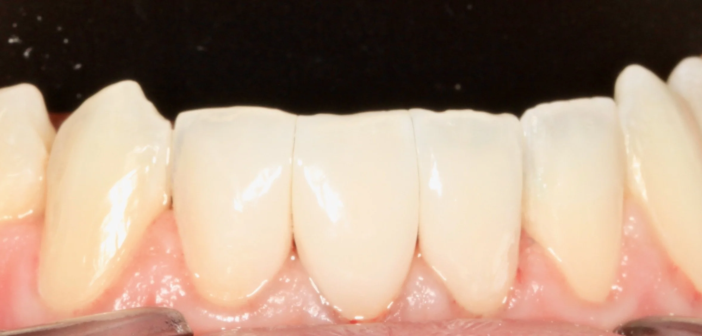 THE BIOCLEAR MATRIX SYSTEM — Maribel M. Vann DDS