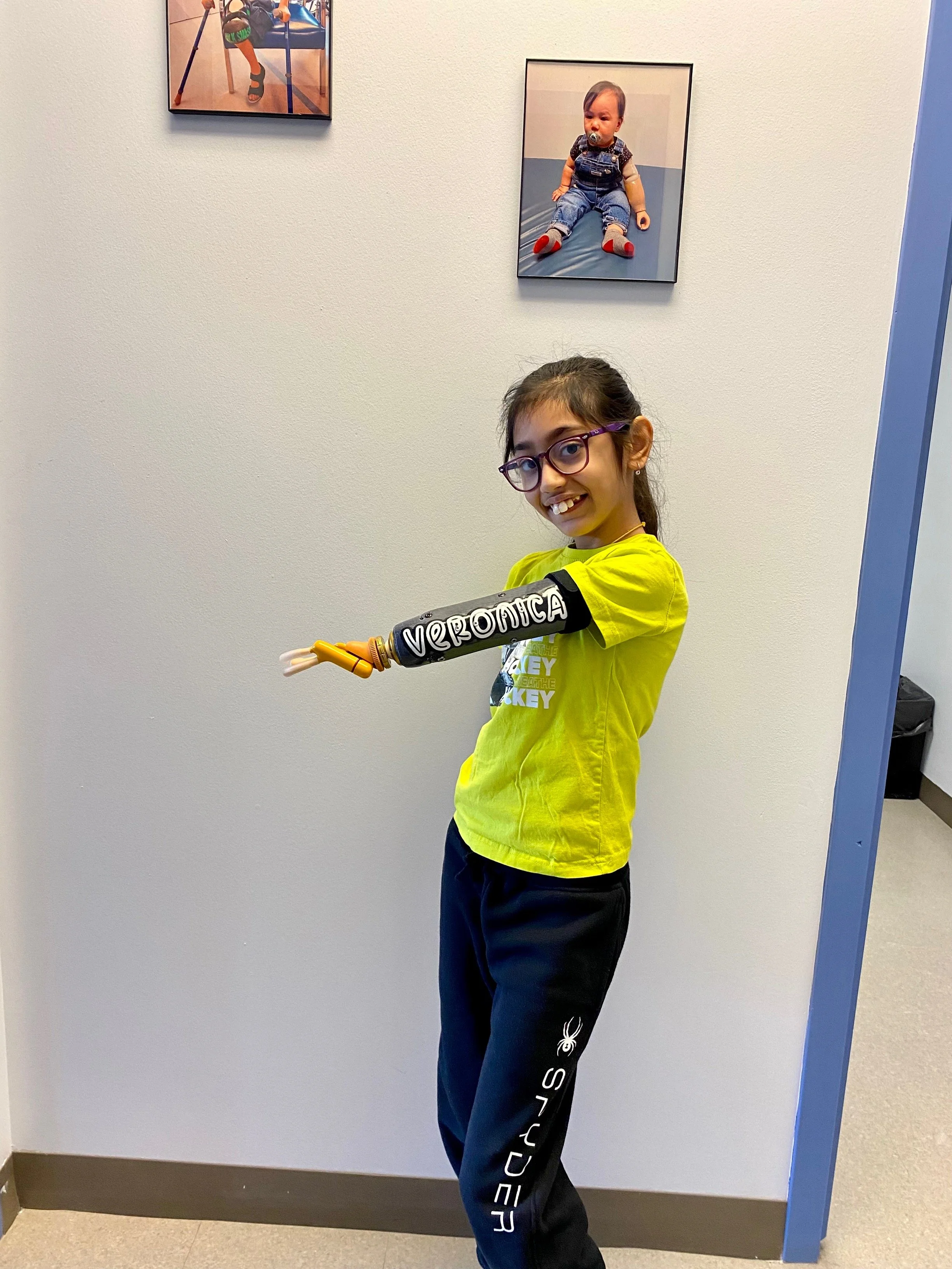 Pediatric Prosthetics and Bracing — Alberta Orthotic & Prosthetic Centre