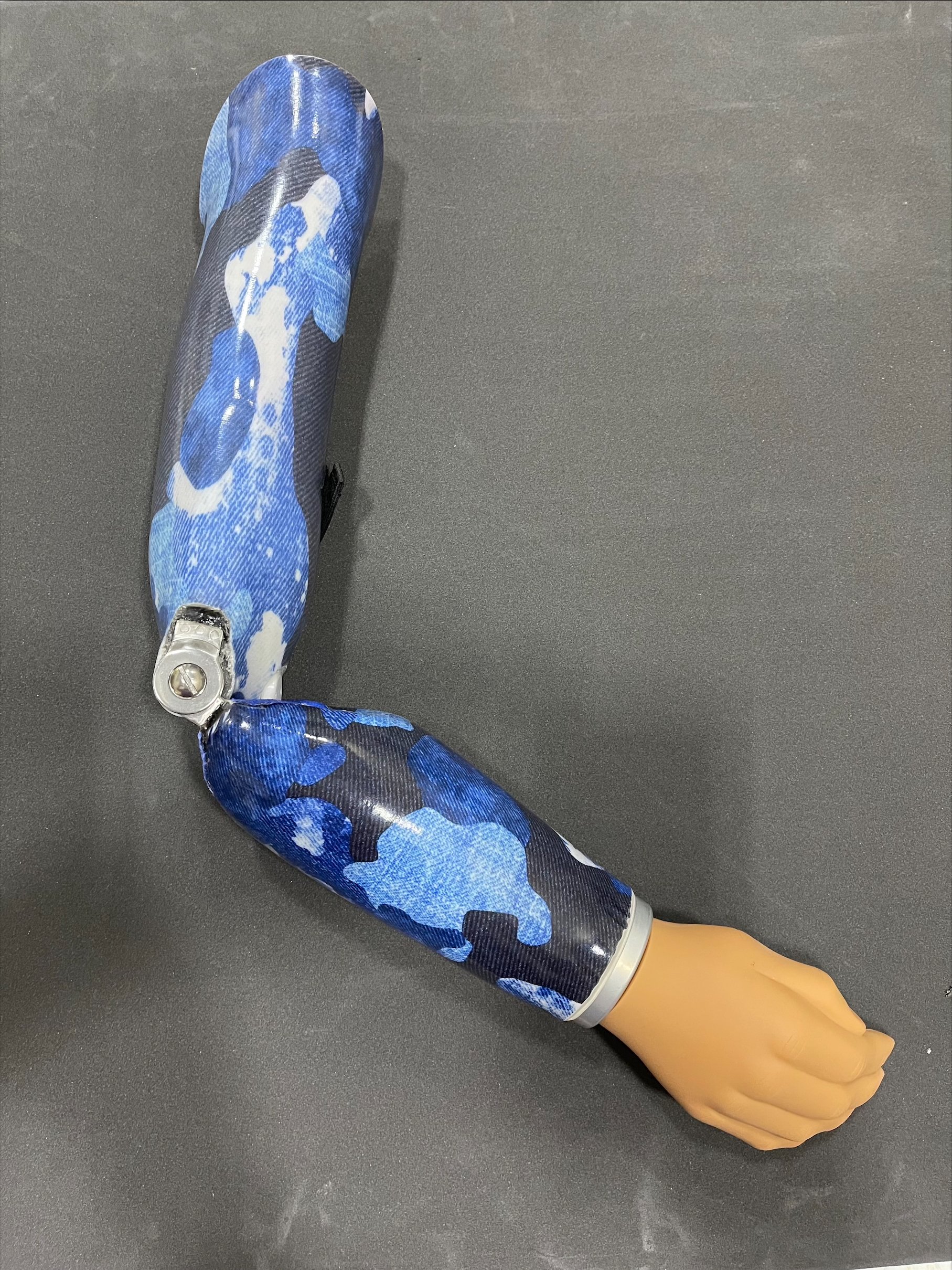 Pediatric Prosthetics and Bracing — Alberta Orthotic & Prosthetic Centre