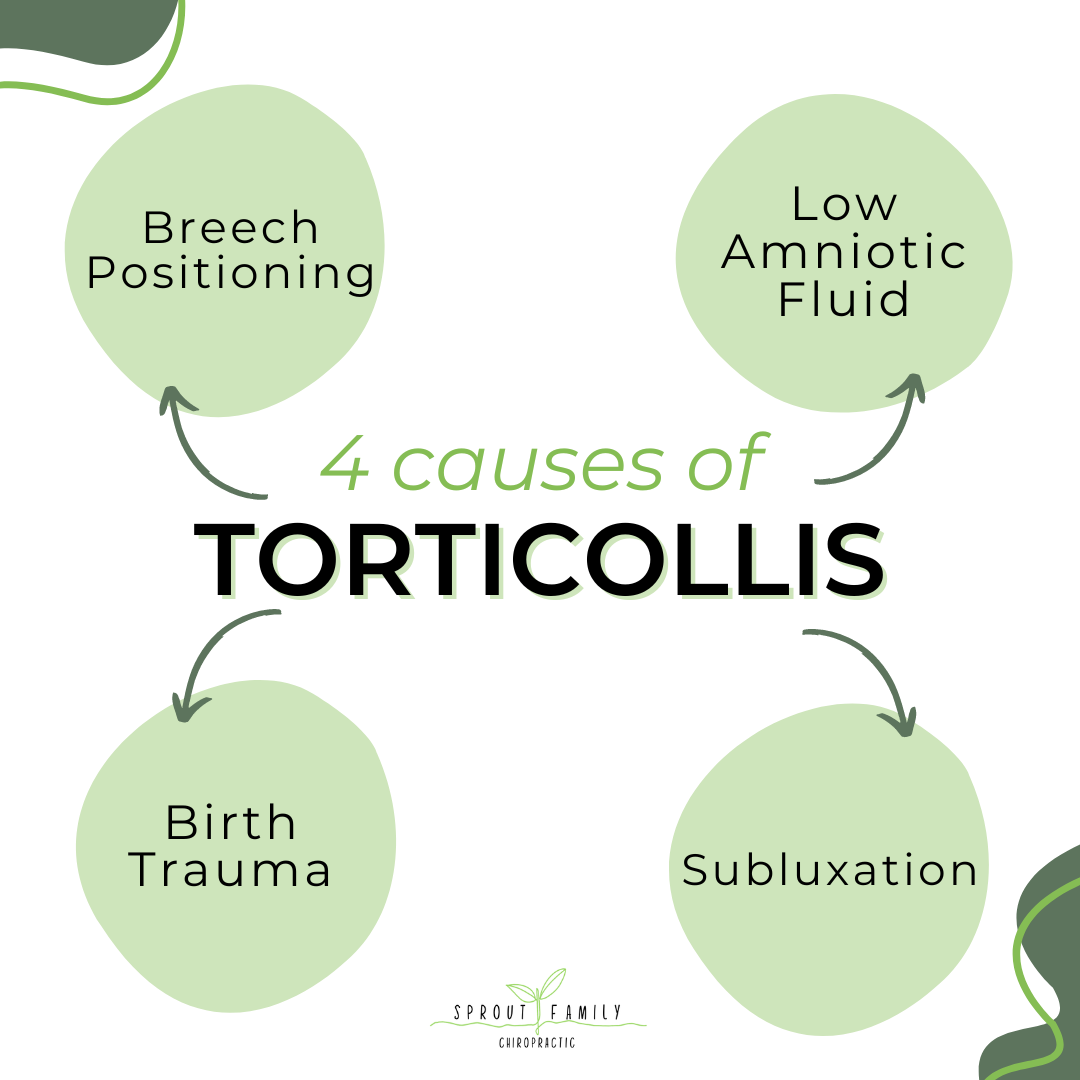 What is Torticollis? | Sprout Family Chiropractic | San Diego CA