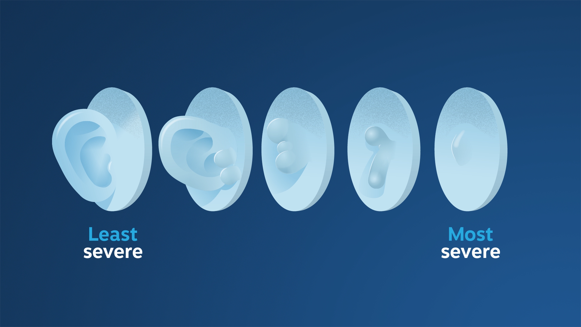 2D medical animation of ear reconstruction surgery — Now Medical Studios