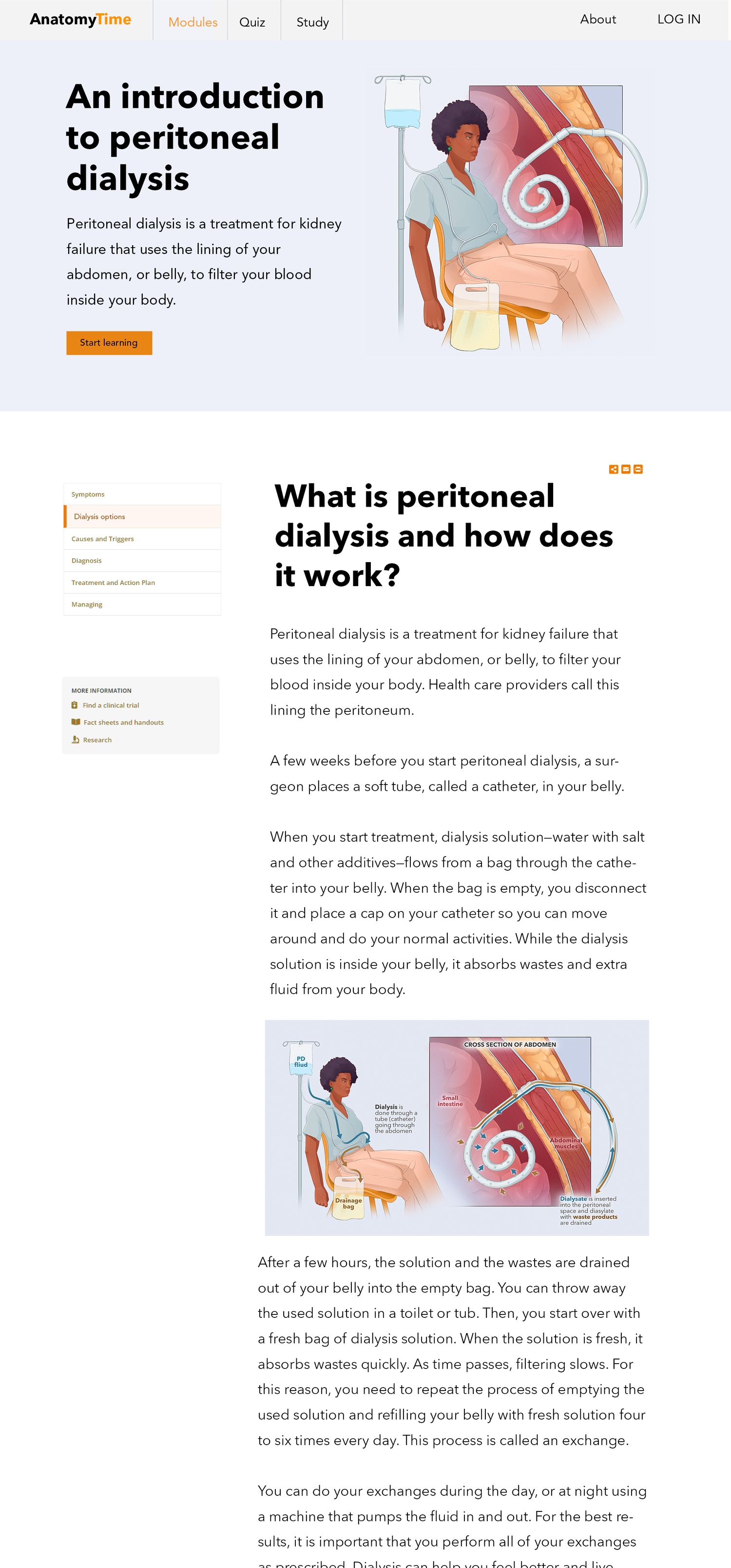 Peritoneal Dialysis | Medical illustration — Now Medical Studios