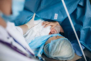 Cesarean Birth Recovery: 9 Essential Self-Care Tips for Faster Healing ...