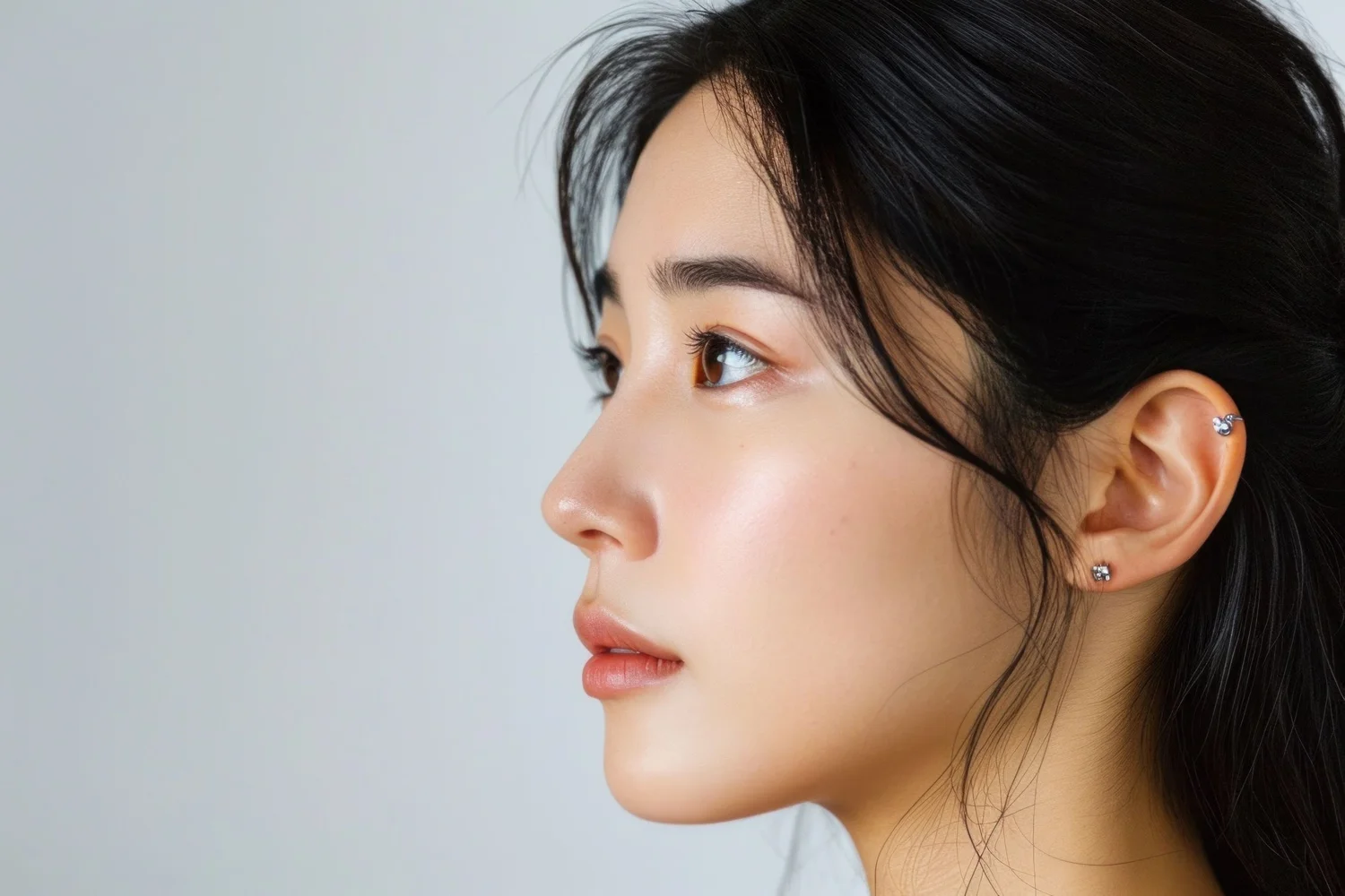 Asian Non-Incisional Double Eyelid Surgery - Vancouver's Aesthetic ...