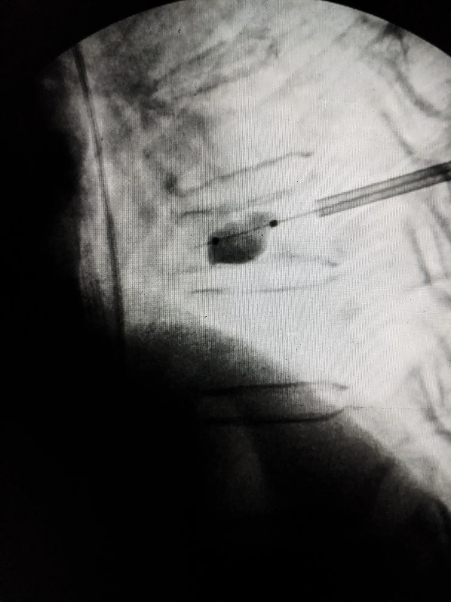Dr. E Joe Kent III, MD - Interventional Pain Management