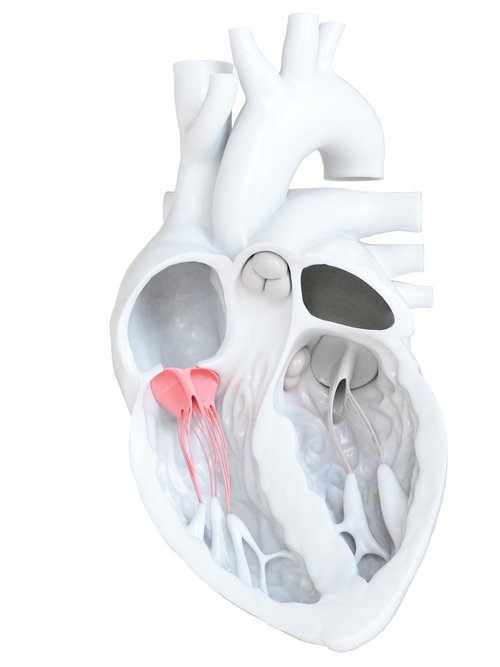 CroíValve