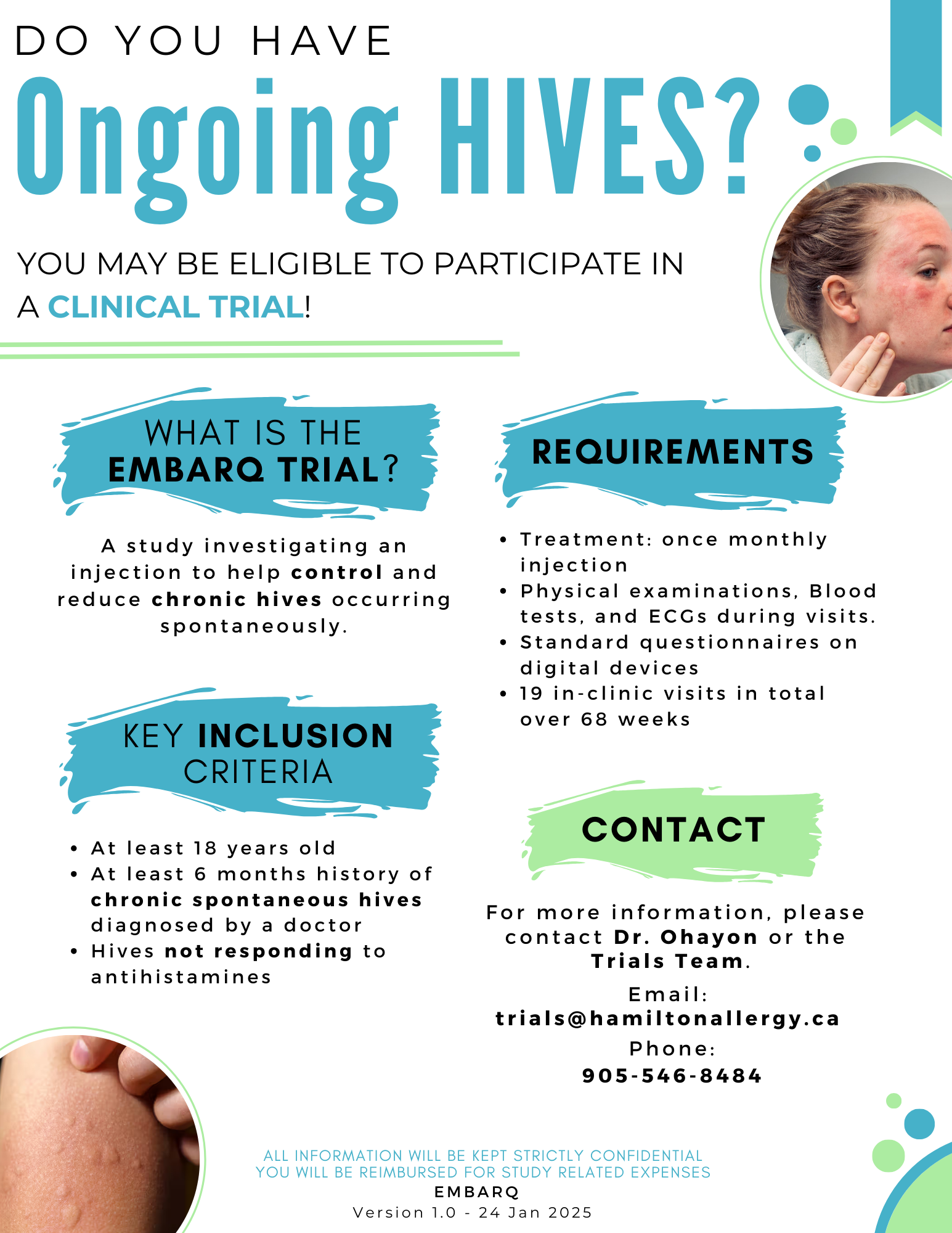 Chronic Hives (18+) — Hamilton Allergy - Allergy Clinic and Clinical Trials