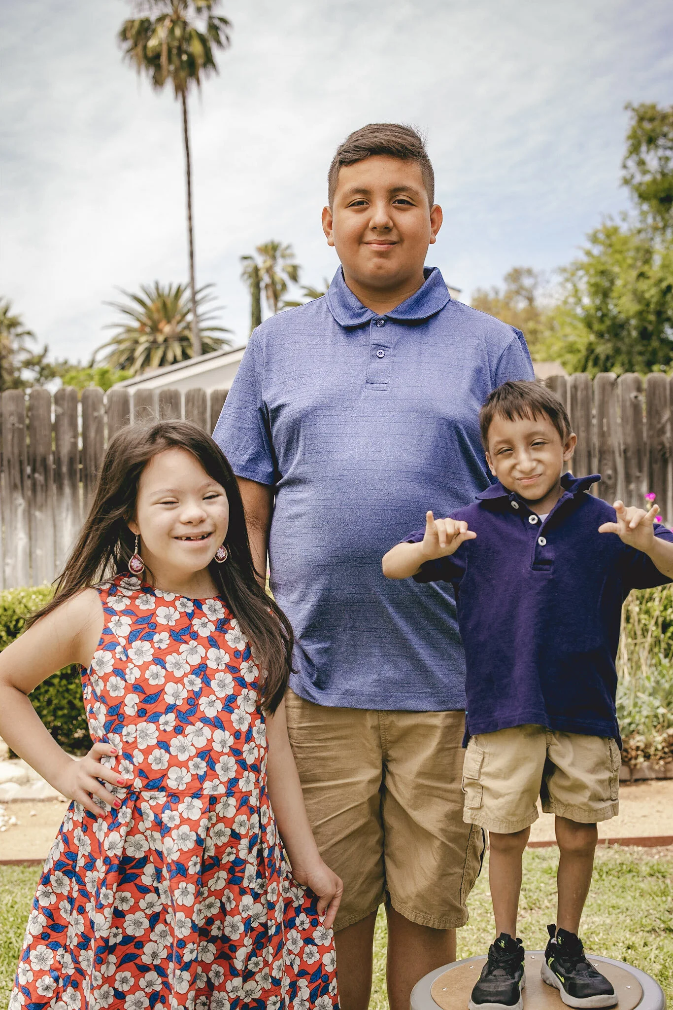 Primordial Dwarfism Twins